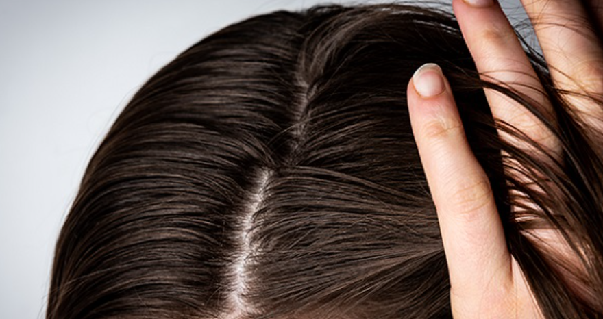 Cuidados para la sensibilidad capilar - Belleza y Alma